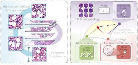 논문 리뷰 Dscenet Dynamic Screening And Clinical Enhanced Multimodal Fusion For Mpns Subtype