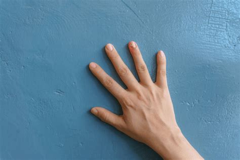 Bệnh Vảy Nến Móng Tay Triệu Chứng Và Cách điều Trị • Hello Bacsi