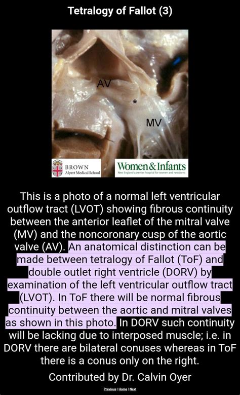 Farid Esmaeili On Linkedin Dorv Tof