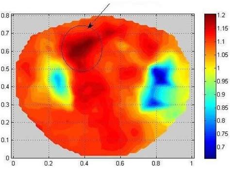 Phase Synchronization In High Density Interictal Scalp Eeg Relationship To Epileptogenic Regions