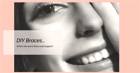 Diy Braces Whats The Worst That Could Happen Dr Brittany Dickinson
