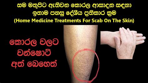 කොරල සුව කරන පහසු අත් බෙහෙත් Korala Walata Ath Beheth Sinhala Youtube