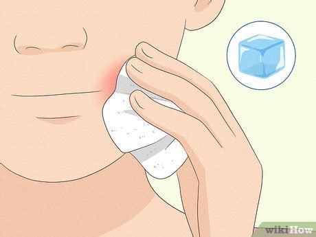 Dry Socket Symptoms Proven Treatments Safe Foods Prevention