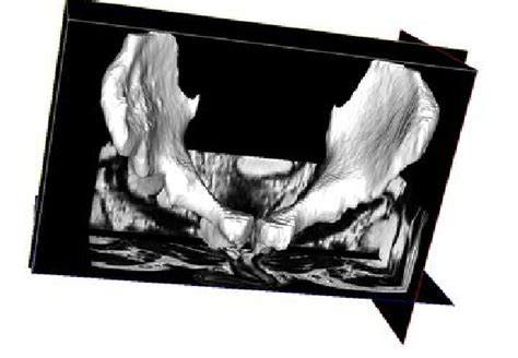 a statistical shape model based on the shape of the pelvis in 21 adult