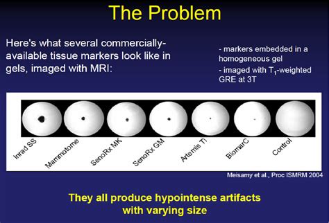 Figure 1 From New Soft Tissue Marker Optimized For Mriultrasound And