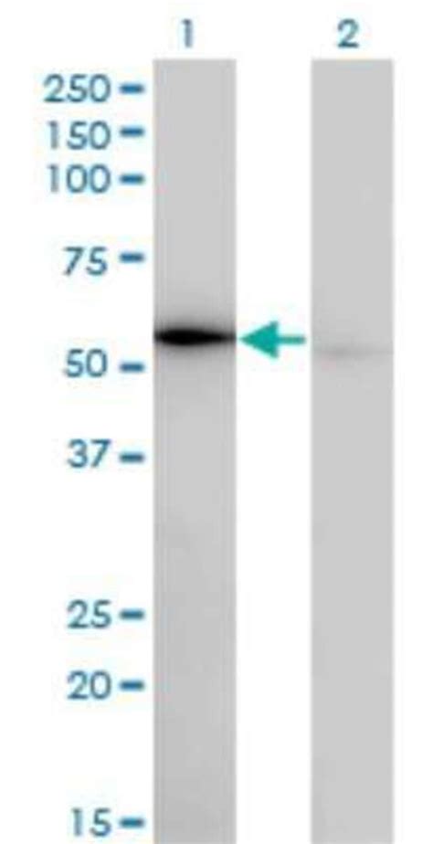 Tryptophanyl Trna Synthetase Antibody 3a12 Novus Biologicals™ 01 Mg