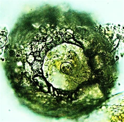 Difflugia Globulosa Tecamebas Difflugia Globulosa Tecamebas