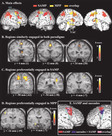 Functional Mri Results A Activation Patterns Shown On Lateral And
