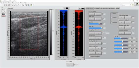 Research Beamformed Rf Data Telemed Ultrasound