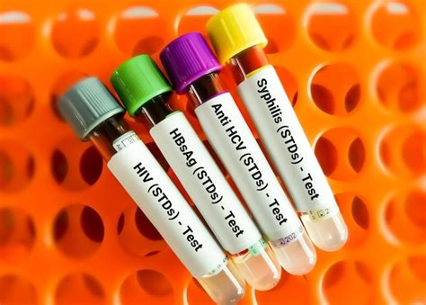 Premium Photo Close View Of Scientist Hand Hold Blood Samples For Sexually Transmitted Disease