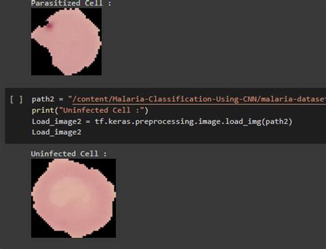 Github Toof04malaria Detection Ml Classification Of Rbcs If They