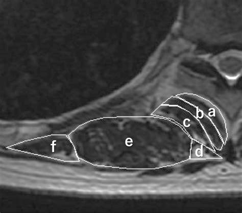 Posterior Extensor Muscles Visualized On An Axial T2 Weighted Image Download Scientific