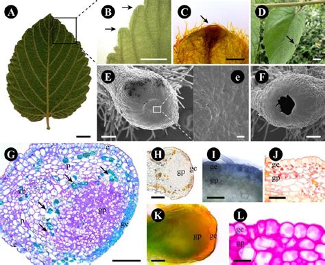 Figure 1 From Diversity Of Leaf Glands And Their Putative Functions In Rhamnaceae Species