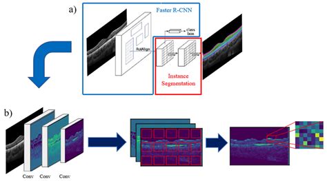 A Framework Of The Mask R Cnn Method Used For Retinal And Choroid Download Scientific Diagram