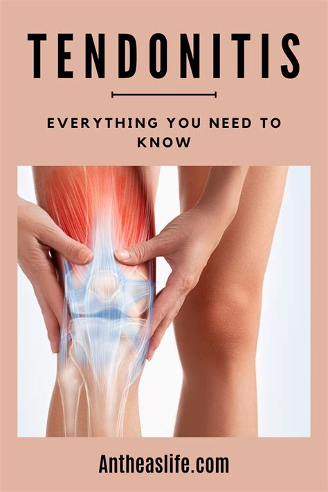 Tendonitis Everything You Need To Know
