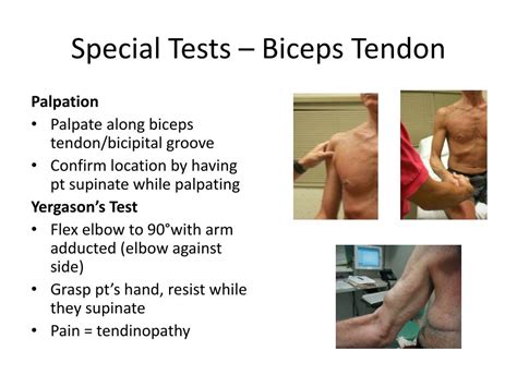Yergason Test Bicep Tendonitis