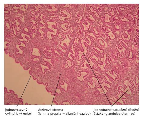 Uterus Histological Slide Wikilectures