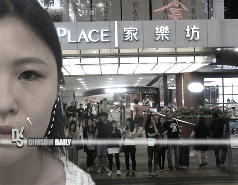 Chp Investigates Mycobacterium Abscessus Infection Case Involving 24