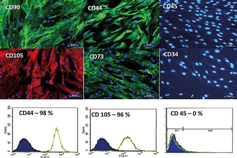 Biodegradable Nanofiber Coated Human Umbilical Cord As Nerve Scaffold For Sciatic Nerve