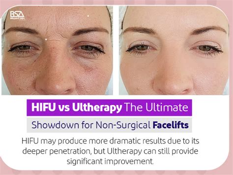 Hifu Vs Ultherapy The Ultimate Showdown For Non Surgical Facelifts