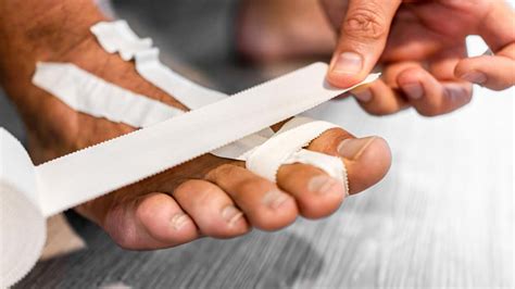 You Can Actually Do Something About Broken Toes Lifehacker