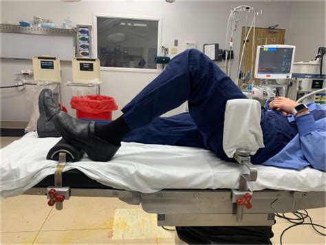 Total Knee Arthroplasty After Ipsilateral Below Knee Amputation A