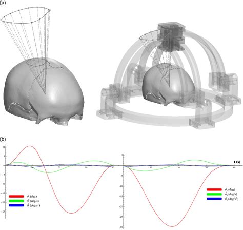 Development Of A Spherical Parallel Manipulator For Brain Surgery Applications Preliminary