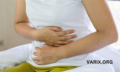 Gastric Varices Causes Risk Factors Symptoms Diagnosis Treatment And Prevention