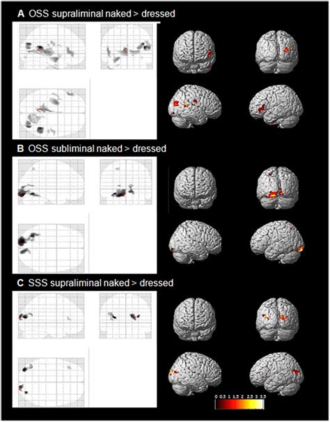 Inverse Solution For The N1 Component Inverse Solution On The Basis Of Download Scientific