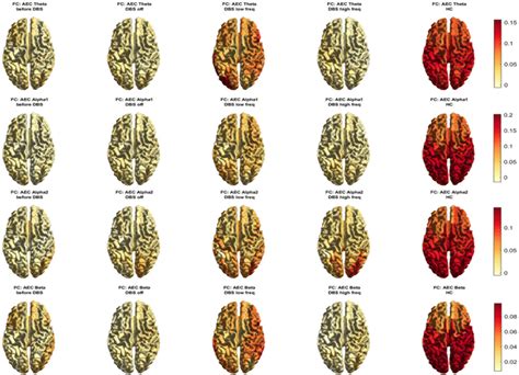Meg Functional Connectivity Aecc For The Four Different Conditions In Download Scientific