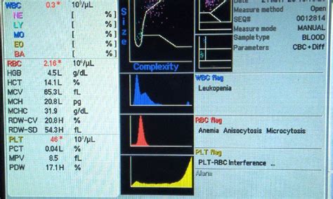 Figure 3 From Correlation Of Peripheral Smear With Rbc Indices And Rbc Histogram In The