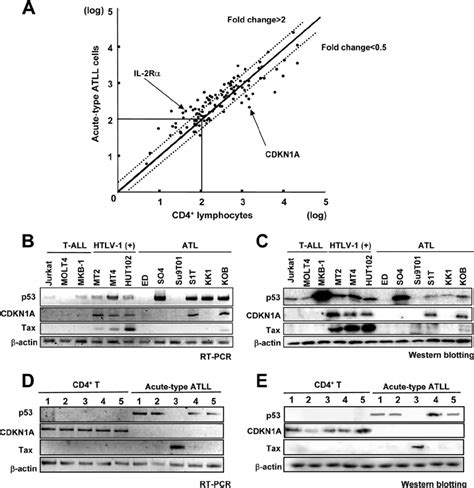 downregulation of cdkn1a in atll cells a cdna microarray analysis of
