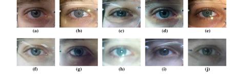 Examples Of Images From Each Subset Of The Csip Database From Aj