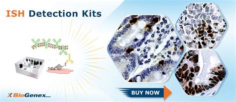 Biogenex On Linkedin Ish Insituhybridization Detectionkits Primaryantibodies Dna Rna…