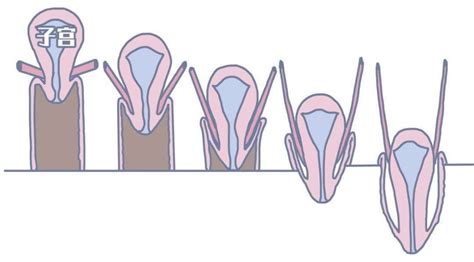 引起子宫脱垂的原因有哪些女生须知 腾讯新闻