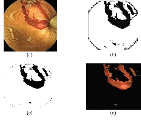 Figure 1 From An Automatic Bleeding Detection Technique In Wireless