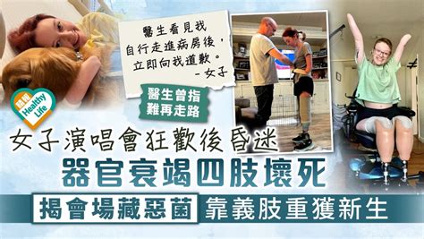 生命奇迹｜女子演唱會狂歡後昏迷 器官衰竭四肢壞死 揭會場藏惡菌靠義肢重獲新生 晴報 健康 其他疾病 D230425