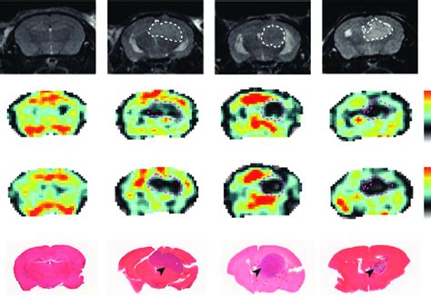 Noninvasive Imaging Of The Viscoelastic Properties Of Intracranial