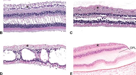 Macula Lutea Histology
