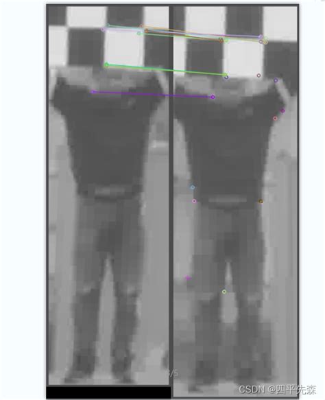 障碍物检测算法开发 （1）三种测距算法技术路线和实际应用障碍物识别算法 Csdn博客