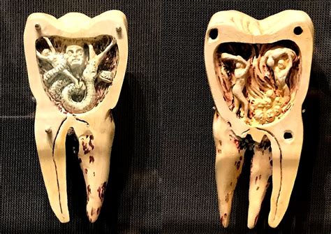 The Tooth Worm And The Way Science Works