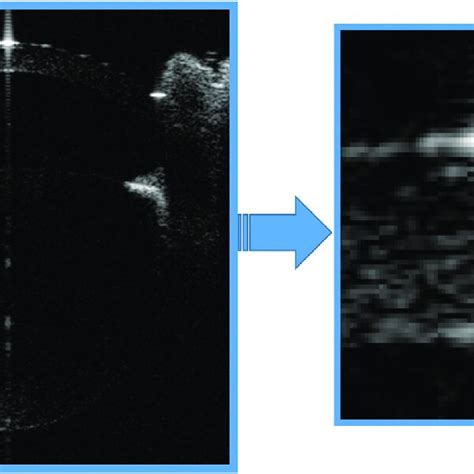 blurred boundaries with low contrast in a chick s cornea although the