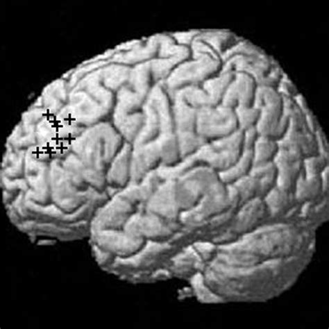 Ssrt In Trials With Single Pulse Tms Stimulation Ssrt Was