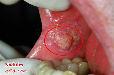 Power Smile Dental Care Wiraketiya