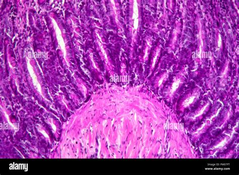 Small Intestine Slide