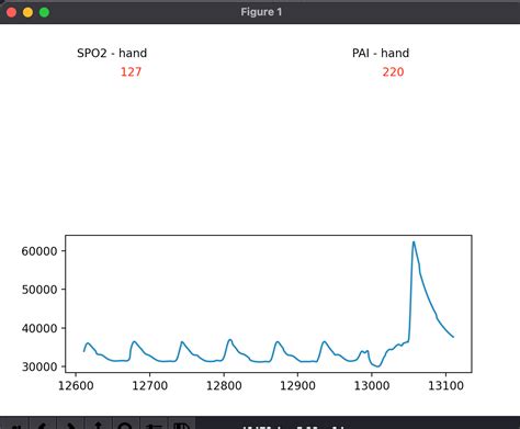 Github Wasdwasd Nonin Ble Python A Python Program Can Receive Record And Plot Nonin