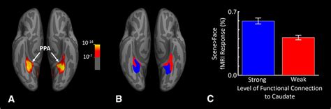 Impact Of Visual Corticostriatal Loop Disruption On Neural Processing Within The Parahippocampal