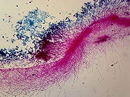 Micro Lab Flashcards Quizlet