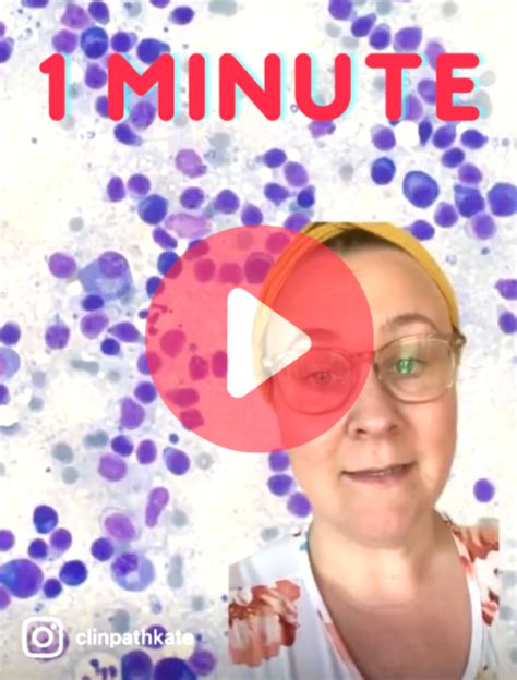 [1 Min Video] Lets Talk About Reactive Lymph Nodes