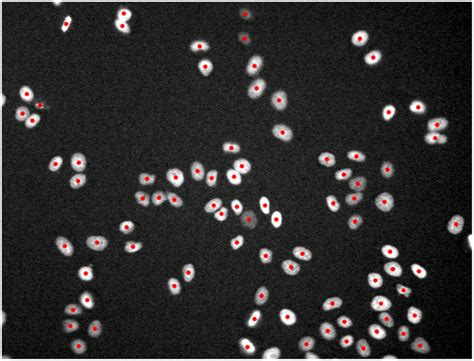 an example of blob structure hela cell nuclei detection the red